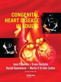 Congenital Heart Disease in Adults | CDON