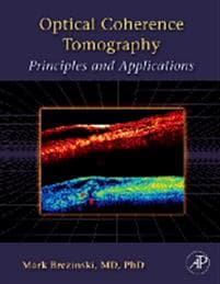 Optical Coherence Tomography | CDON