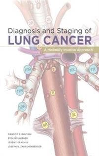 Diagnosis and Staging of Lung Cancer: A Minimally Invasive Approach | CDON