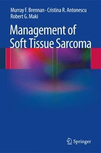 Management of Soft Tissue Sarcoma | CDON
