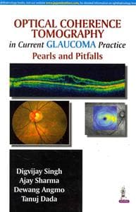 Optical Coherence Tomography in Current Glaucoma Practice | CDON