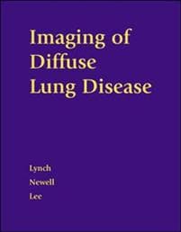 IMAGING OF DIFFUSE LUNG DISEASE | CDON