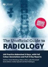 Unofficial Guide To Radiology 100 Practice Abdominal X Rays With Full