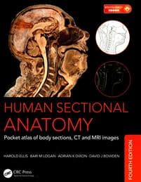 Human Sectional Anatomy | CDON