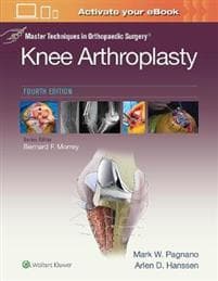 Master Techniques in Orthopedic Surgery: Knee Arthroplasty | CDON