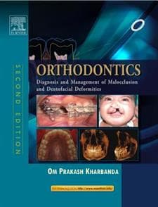 Orthodontics: Diagnosis of & Management of Malocclusion & Dentofacial Deformities | Om Prakash ...