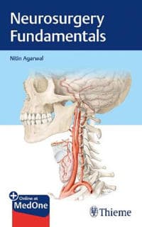 Neurosurgery Fundamentals | CDON