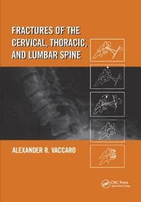 Fractures of the Cervical, Thoracic, and Lumbar Spine | CDON