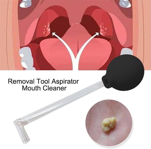 INF Borttagningsverktyg för tonsillstenar | CDON